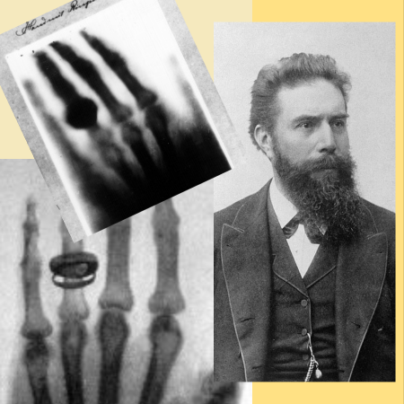 The Development of the X-ray Machine, it's Accessories, and Processes