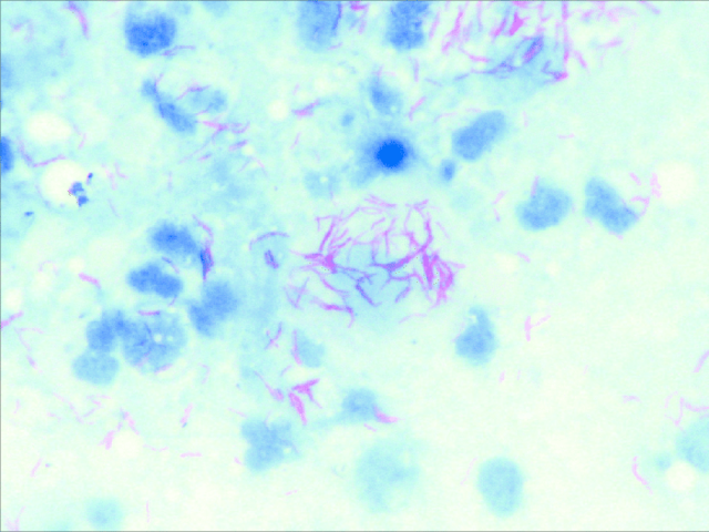 Línea del tiempo de la microbiología timeline | Timetoast timelines