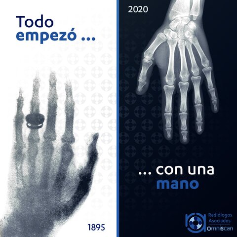 Rayos X timeline | Timetoast timelines