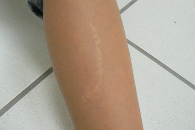 Morgan's LIfe timeline | Timetoast timelines