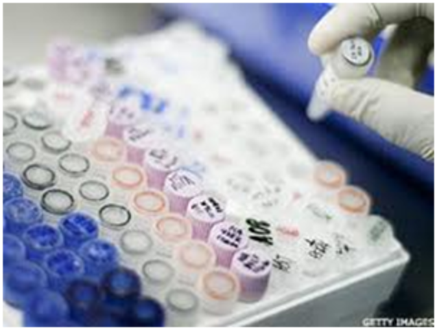 Historia de la enzimología. timeline | Timetoast timelines