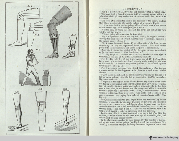 The History and Evolution of Prosthetics timeline | Timetoast timelines