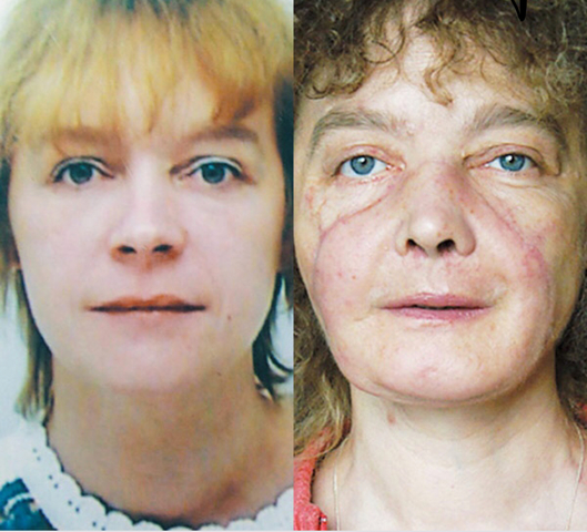 21st Century Health Care Timeline | Timetoast timelines