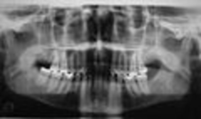 Historia de la Radiología timeline | Timetoast timelines