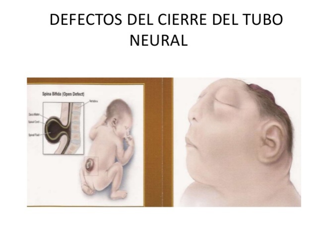 Ontogénesis del Sistema Nervioso. timeline | Timetoast timelines