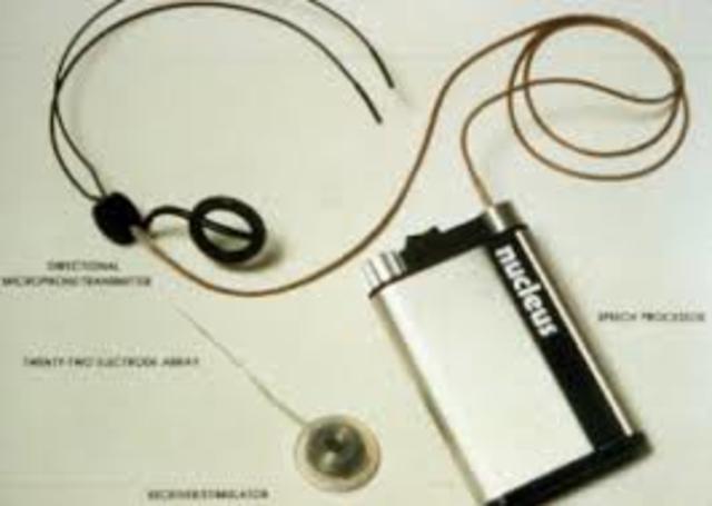 Cochlear Implant Time Line timeline | Timetoast timelines