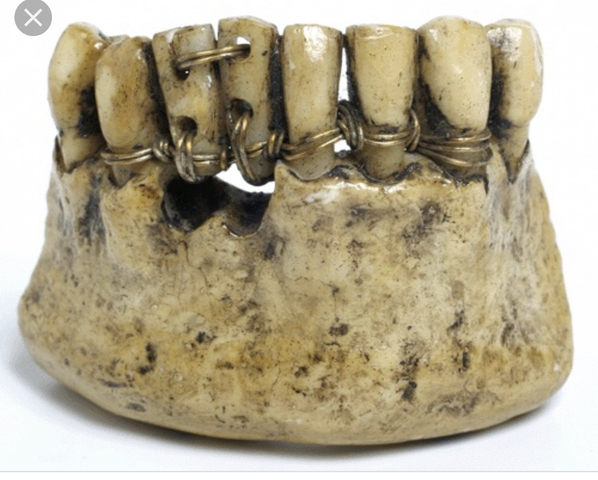 History of Dentistry timeline | Timetoast timelines