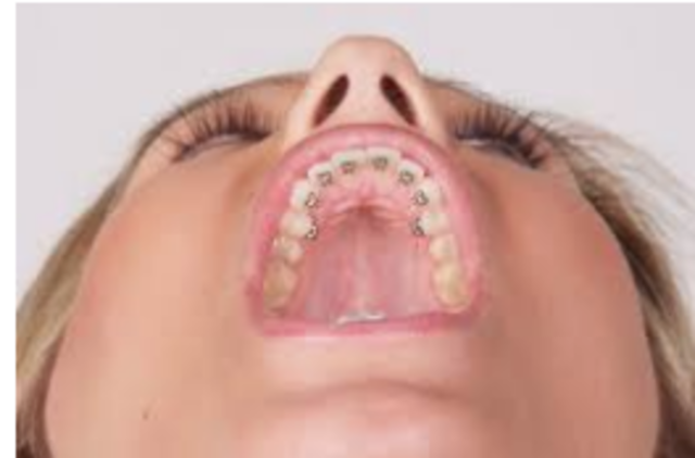 The Evolution Of Orthodontics Timeline Timetoast Timelines