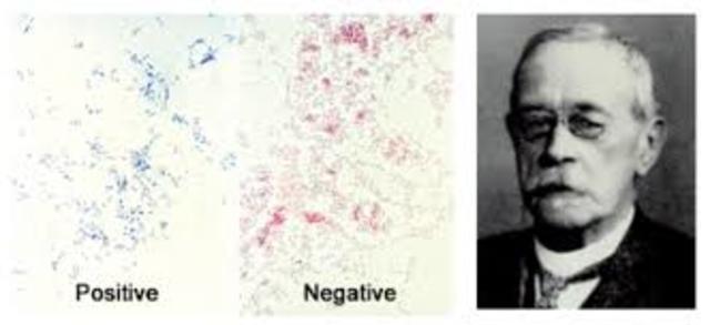 Historia de la Microbiologia de Alimentos timeline | Timetoast timelines