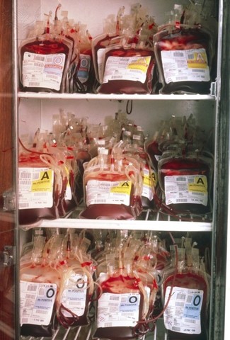 Timeline Of Medicine and Medical Technology 1900's-2000's | Timetoast ...