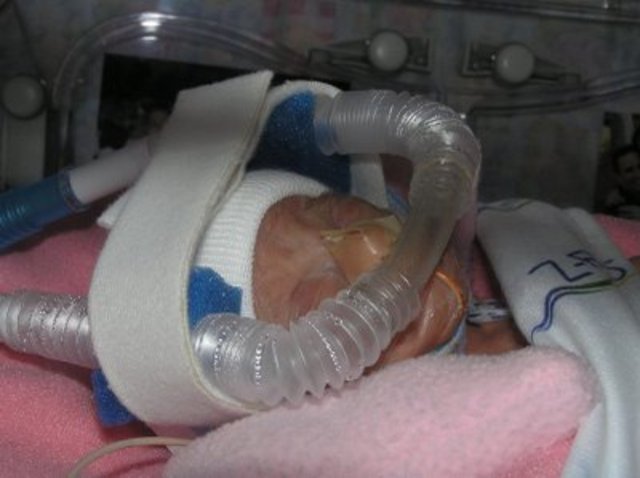 The History of Neonatal Intensive Care Units timeline | Timetoast timelines