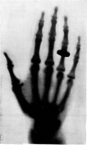 History of Radiation - Science 10 timeline | Timetoast timelines