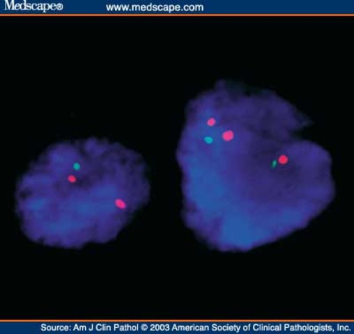 Biology Discoveries in 1700 - 1799 timeline | Timetoast timelines