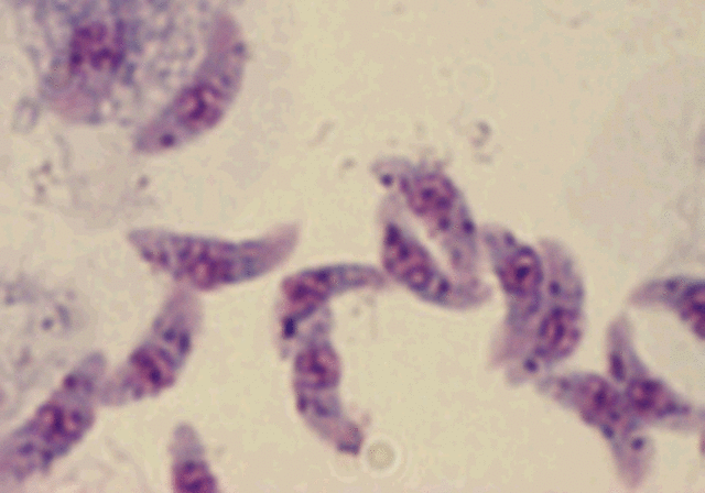 Toxoplasmosis timeline | Timetoast timelines