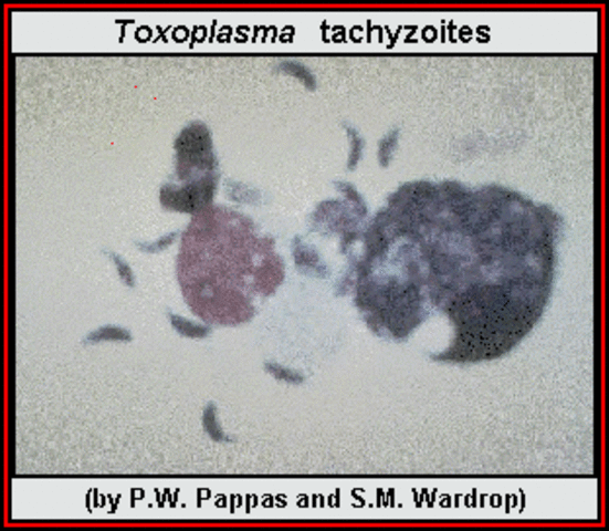 Toxoplasmosis timeline | Timetoast timelines