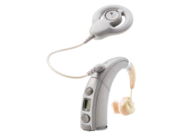 Development of cochlear implants timeline | Timetoast timelines