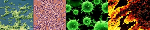 The history of the Germ Theory of Disease timeline | Timetoast timelines