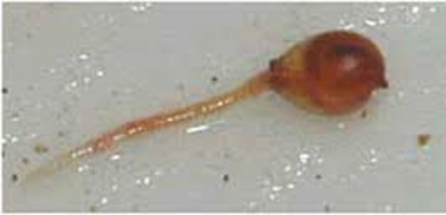 Life Stages of an Earthworm timeline | Timetoast timelines