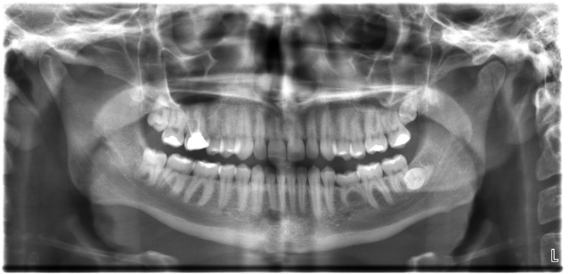 HISTORIA DE LA RADIOLOGÍA DENTAL timeline | Timetoast timelines