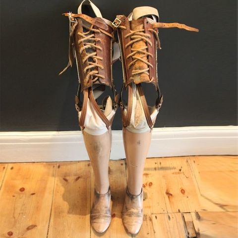 Prosthetics timeline | Timetoast timelines