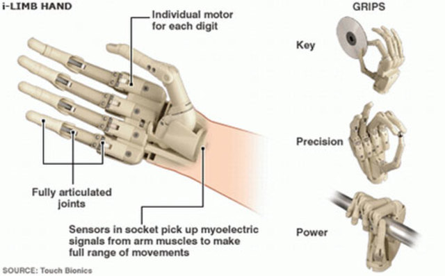 Developments in Prosthetics Throughout years timeline | Timetoast timelines