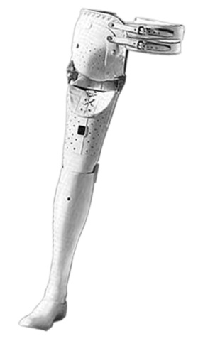 Developments in Prosthetics Throughout years timeline | Timetoast timelines