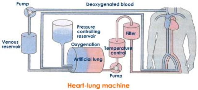The Artificial Heart timeline | Timetoast timelines