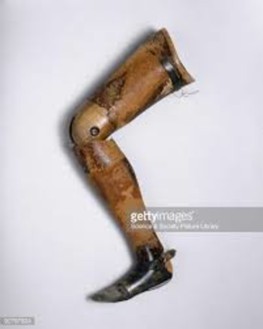 Prosthetic Limb Timeline by Shantanu and Tony | Timetoast timelines