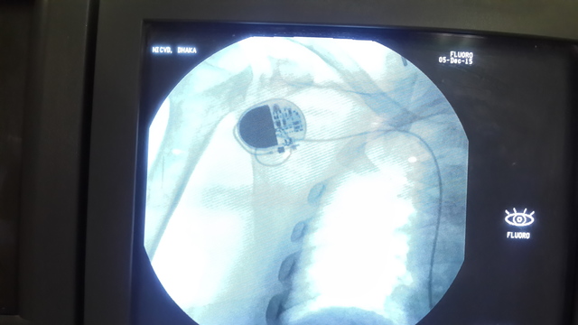 The Evolution of Technologies used to Diagnose and Treat Cardiac ...