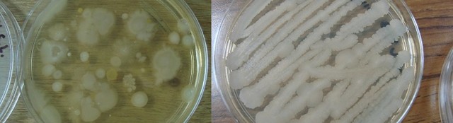 Historia de la Microbiologia timeline | Timetoast timelines