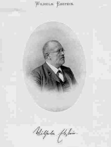 The Diagnosis of Diabetes over Time timeline | Timetoast timelines