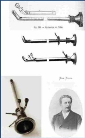 EVOLUCIÓN DE LA ENDOSCOPIA QUIRÚRGICA timeline | Timetoast timelines