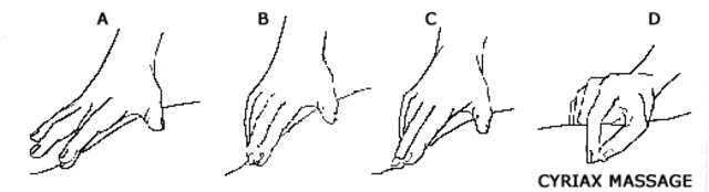 HISTORIA DE TERAPIA MANUAL timeline | Timetoast timelines