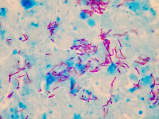 Línea de tiempo acerca de la carrera de Químico Bacteriólogo ...