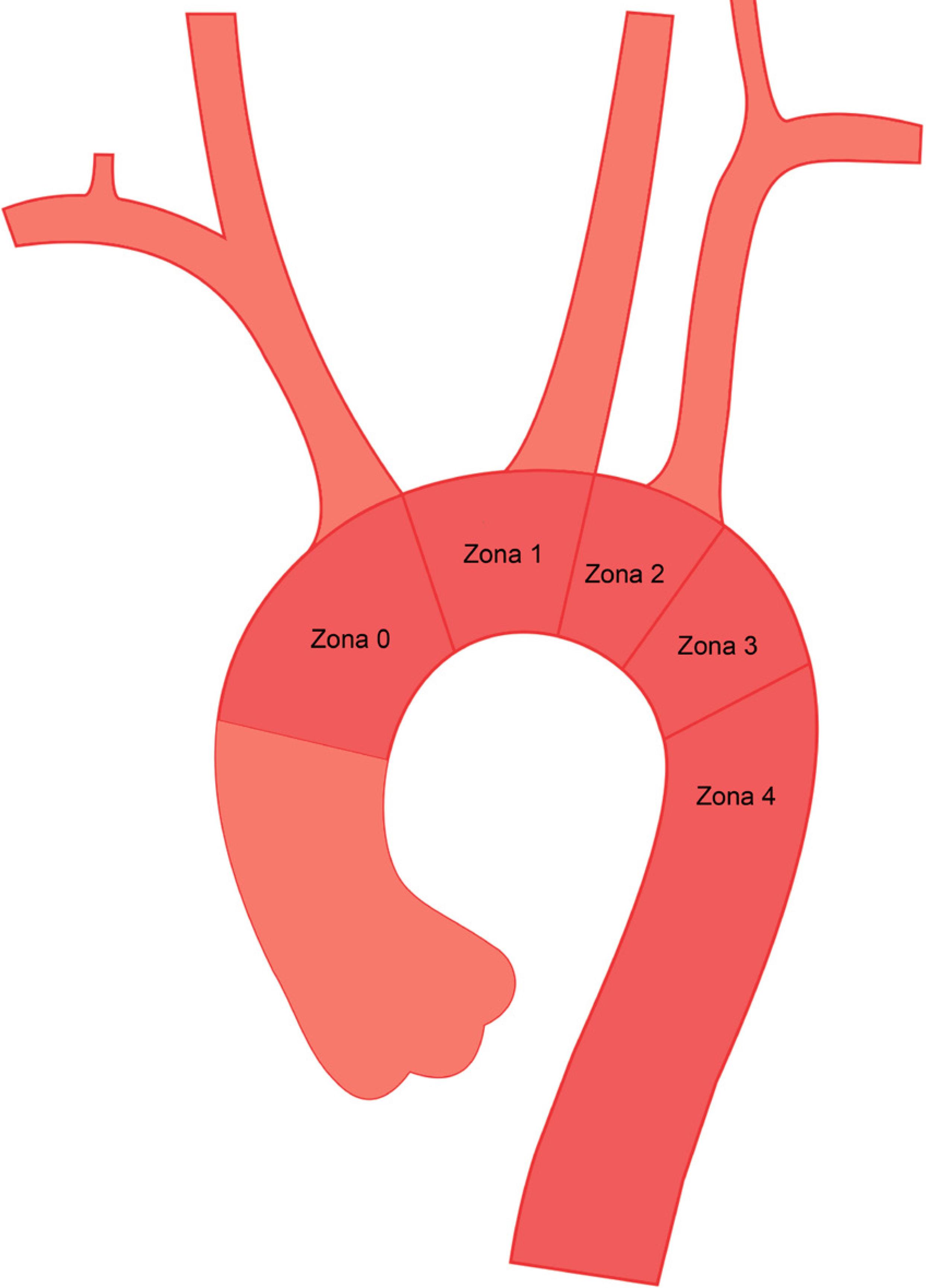 Aortic arch