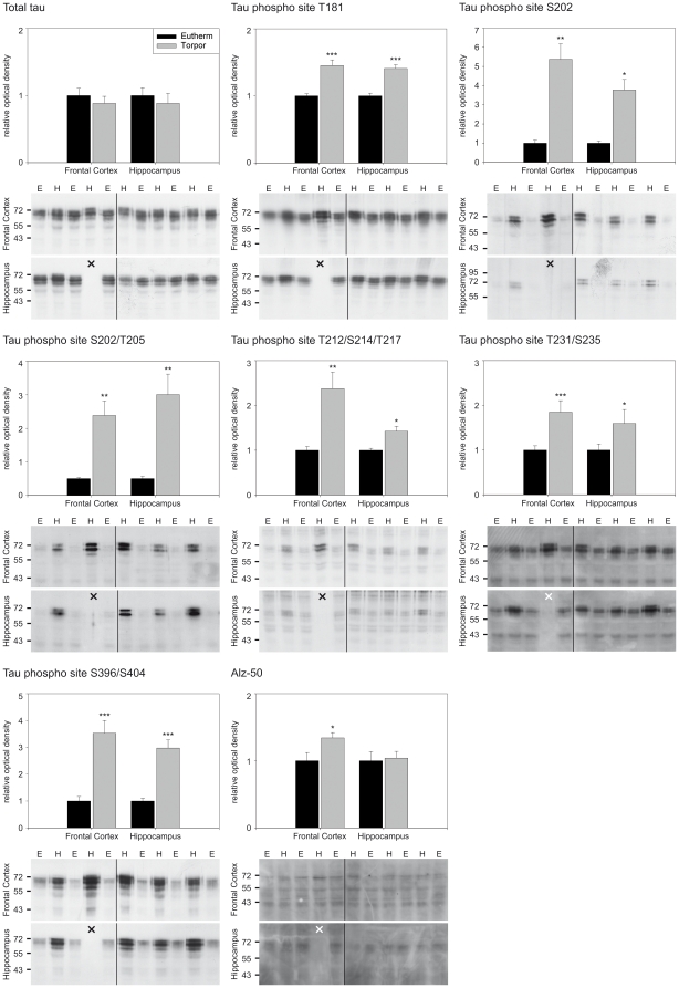 MN1050_Phospho-Tau (Thr181) Monoclonal Antibody (AT270) | e브릭몰