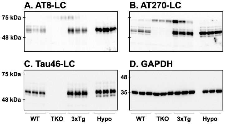 MN1050_Phospho-Tau (Thr181) Monoclonal Antibody (AT270) | e브릭몰