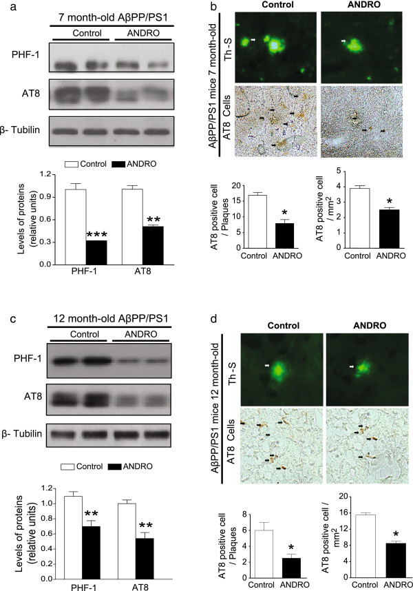 MN1020_Phospho-Tau (Ser202, Thr205) Monoclonal Antibody (AT8) | e브릭몰