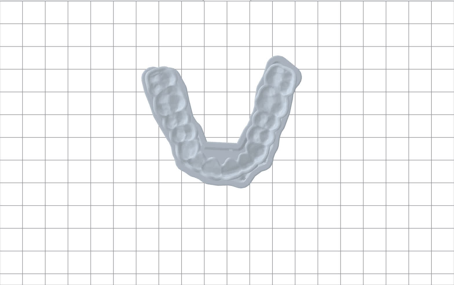 Understanding dental application print speed (Form 4B)
