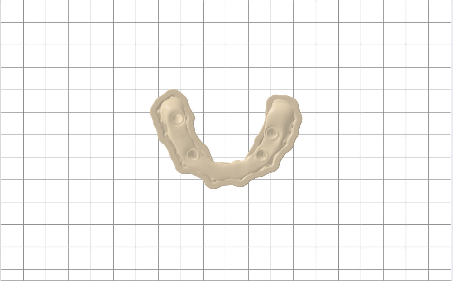 Understanding dental application print speed (Form 4B)