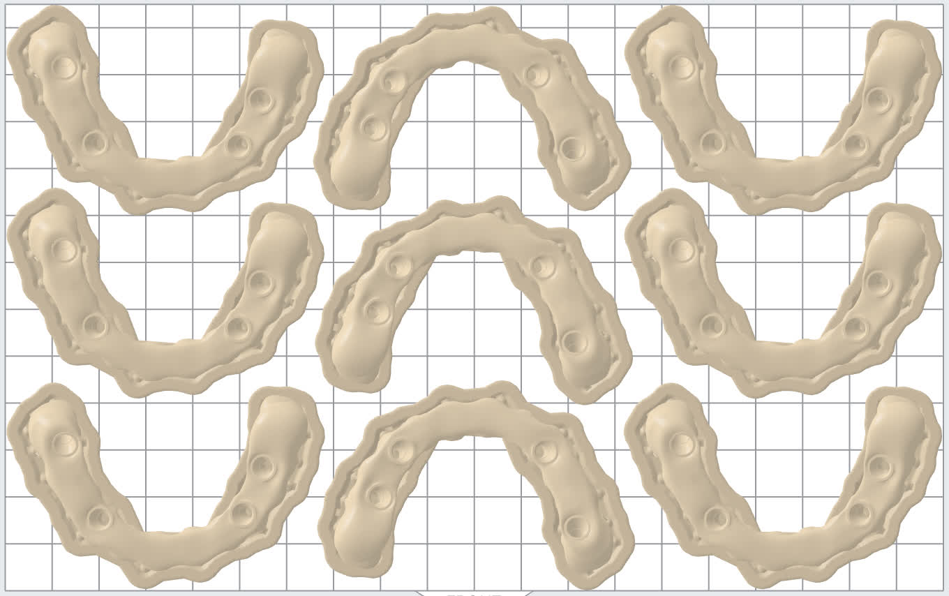 Understanding dental application print speed (Form 4B)
