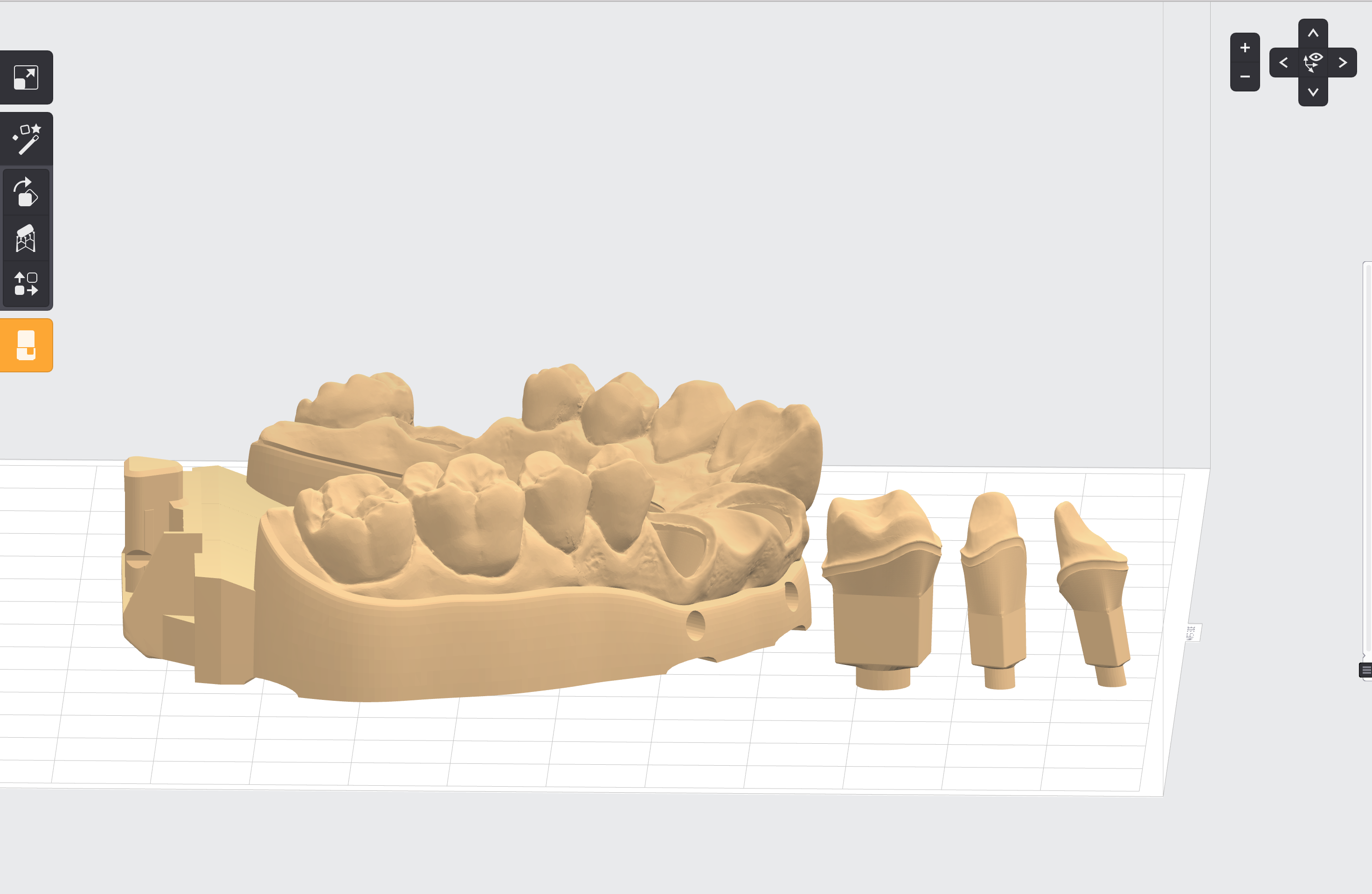 Printing Crown and Bridge Models with Dental Model Resin