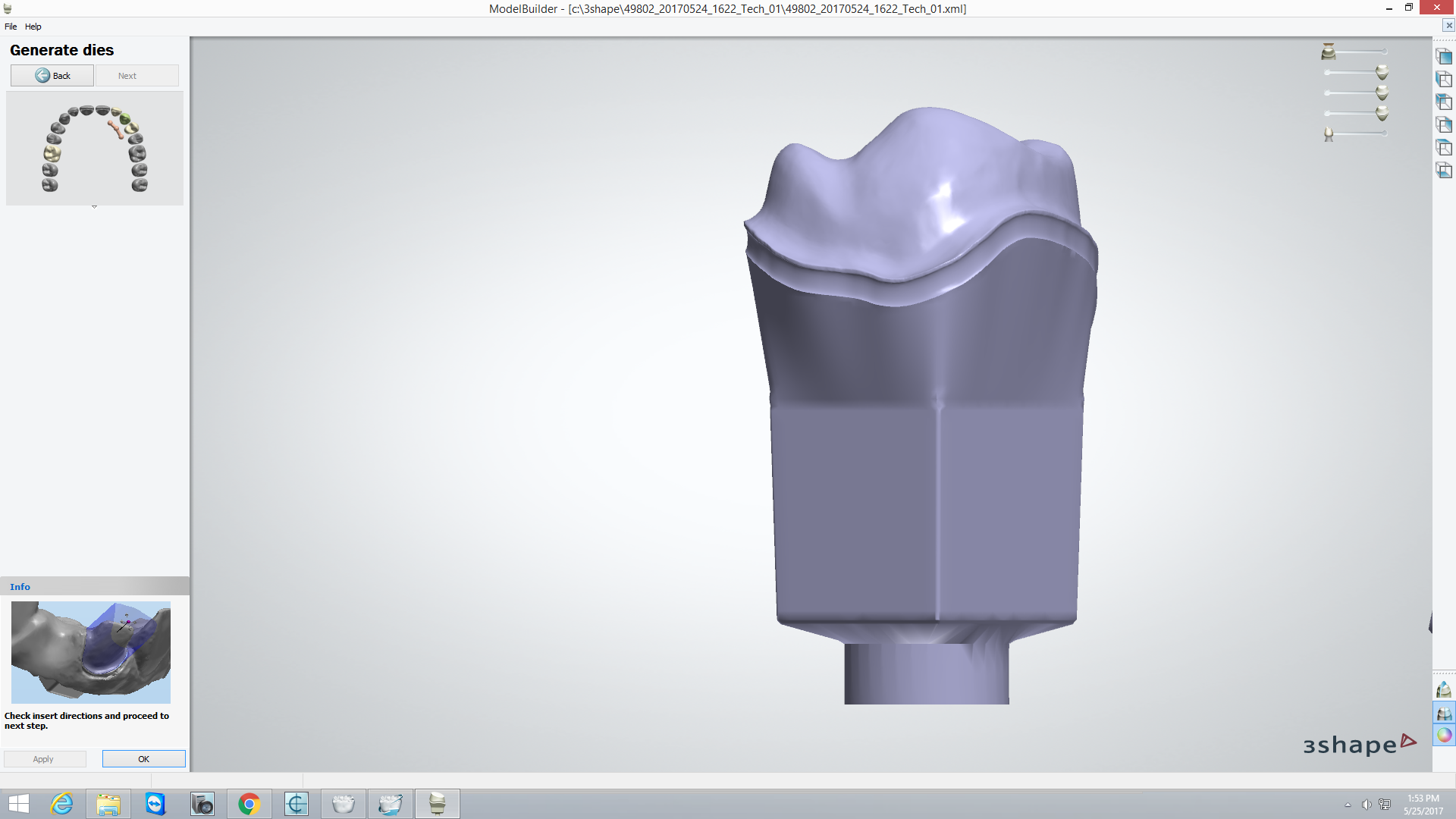Printing Crown and Bridge Models with Dental Model Resin