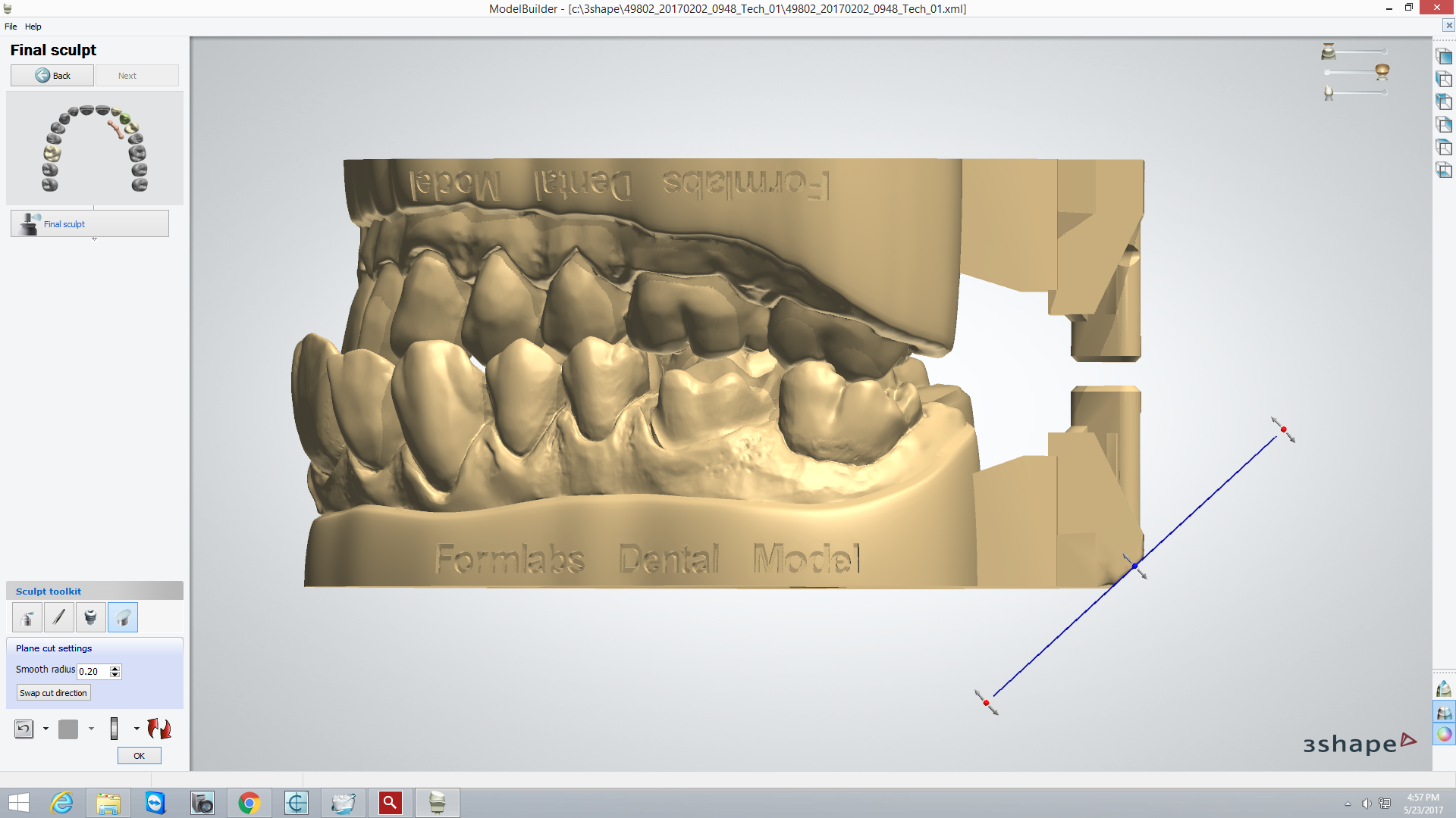 Printing Crown and Bridge Models with Dental Model Resin