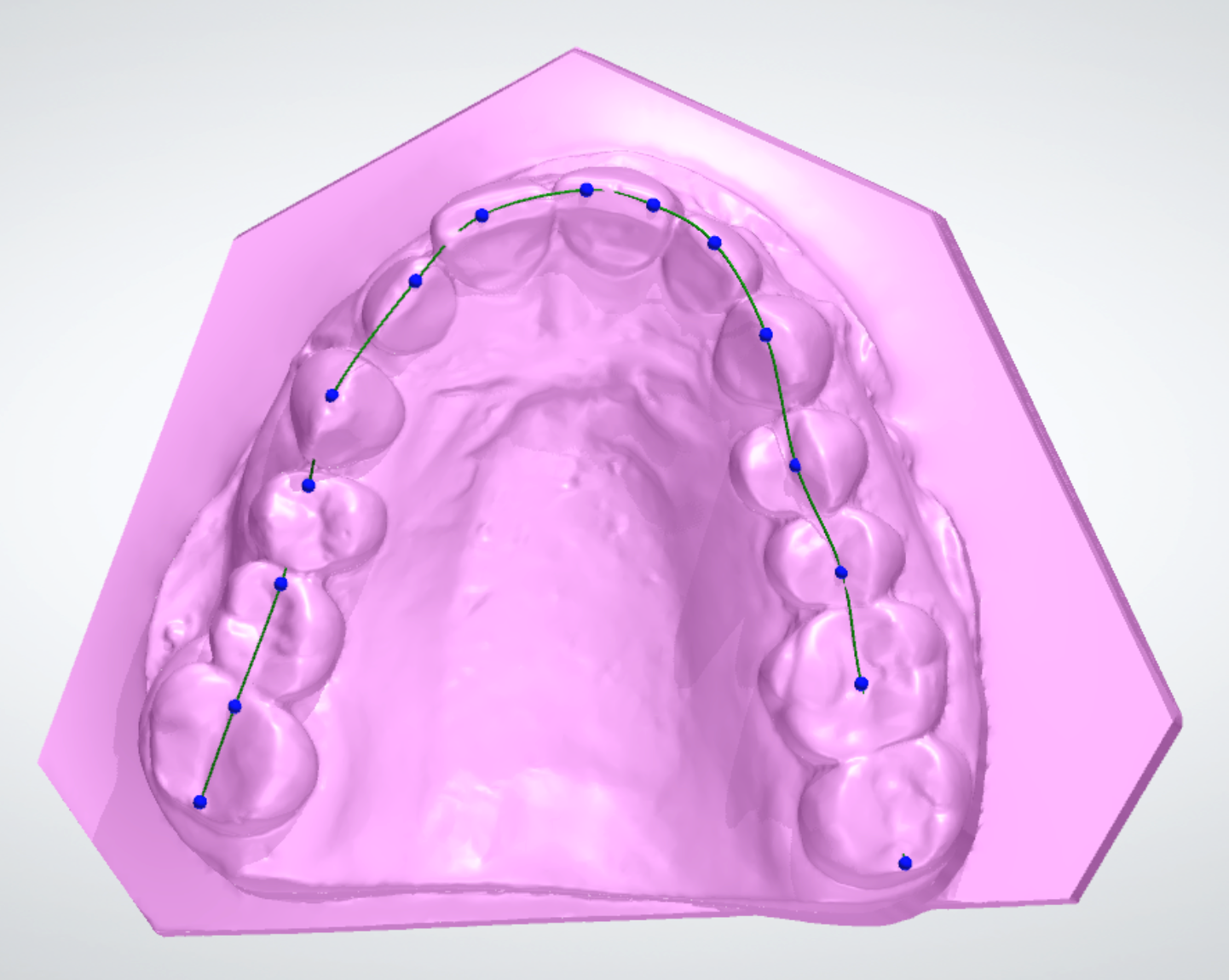 Printing Splints with Dental LT Clear Resin