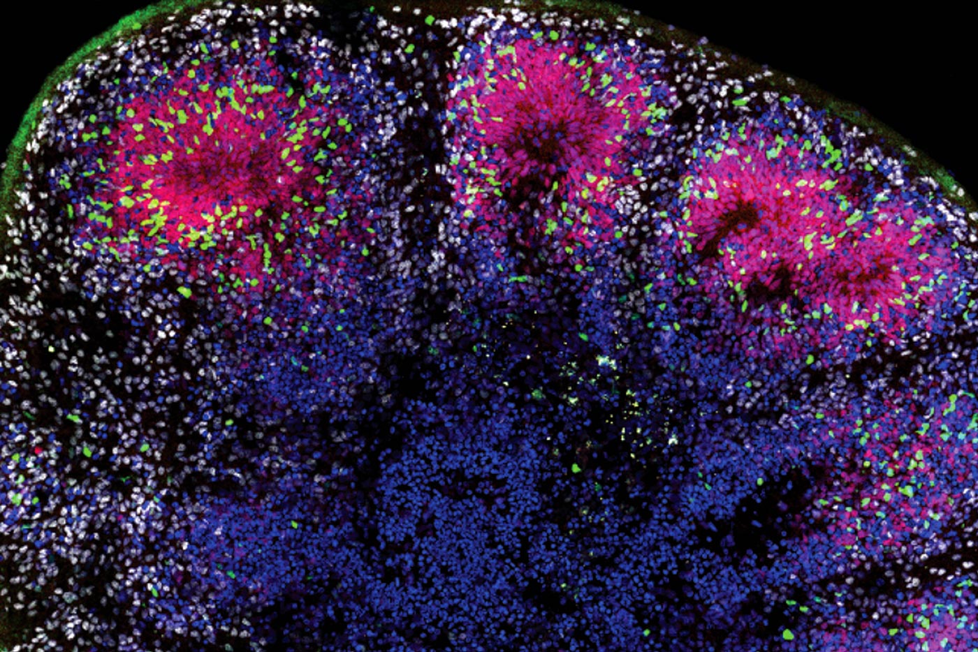 Solving for Early-Career Challenges in Autism Research | Simons ...