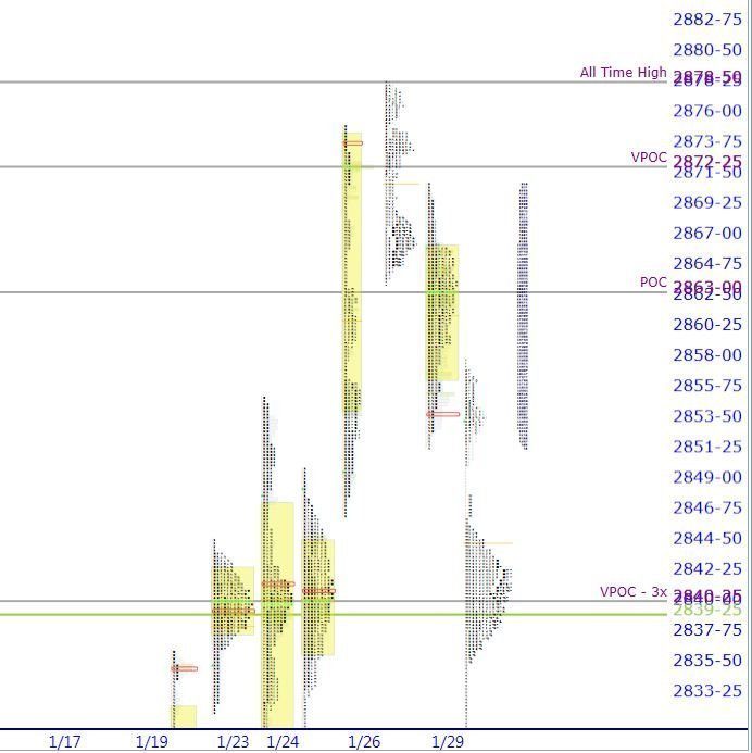 Peter's Premarket Perspective | Shadow Traders