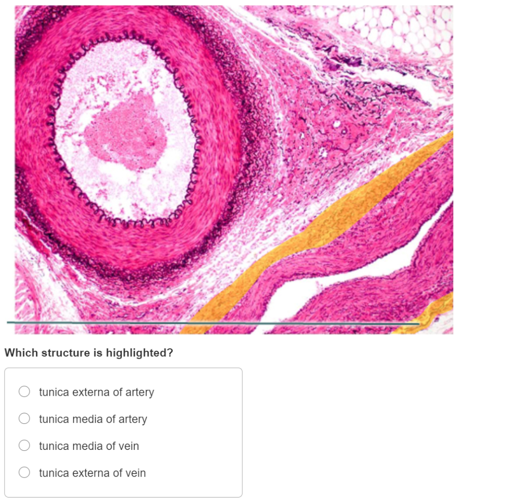 [Solved] Identify the highlighted structure. Ident | SolutionInn