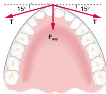 [Solved] What force is exerted on the tooth in Fig | SolutionInn