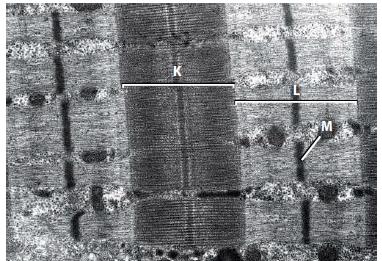 [Solved] The electron micrograph shows parts of so | SolutionInn